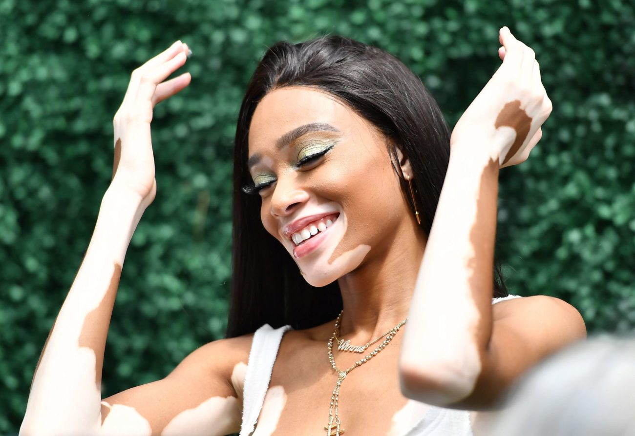 GP Canadá F1 2018: La modelo winnie harlow | MARCA.com