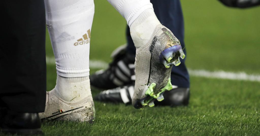 Primer plano del tobillo lesionado de hazard | MARCA.com
