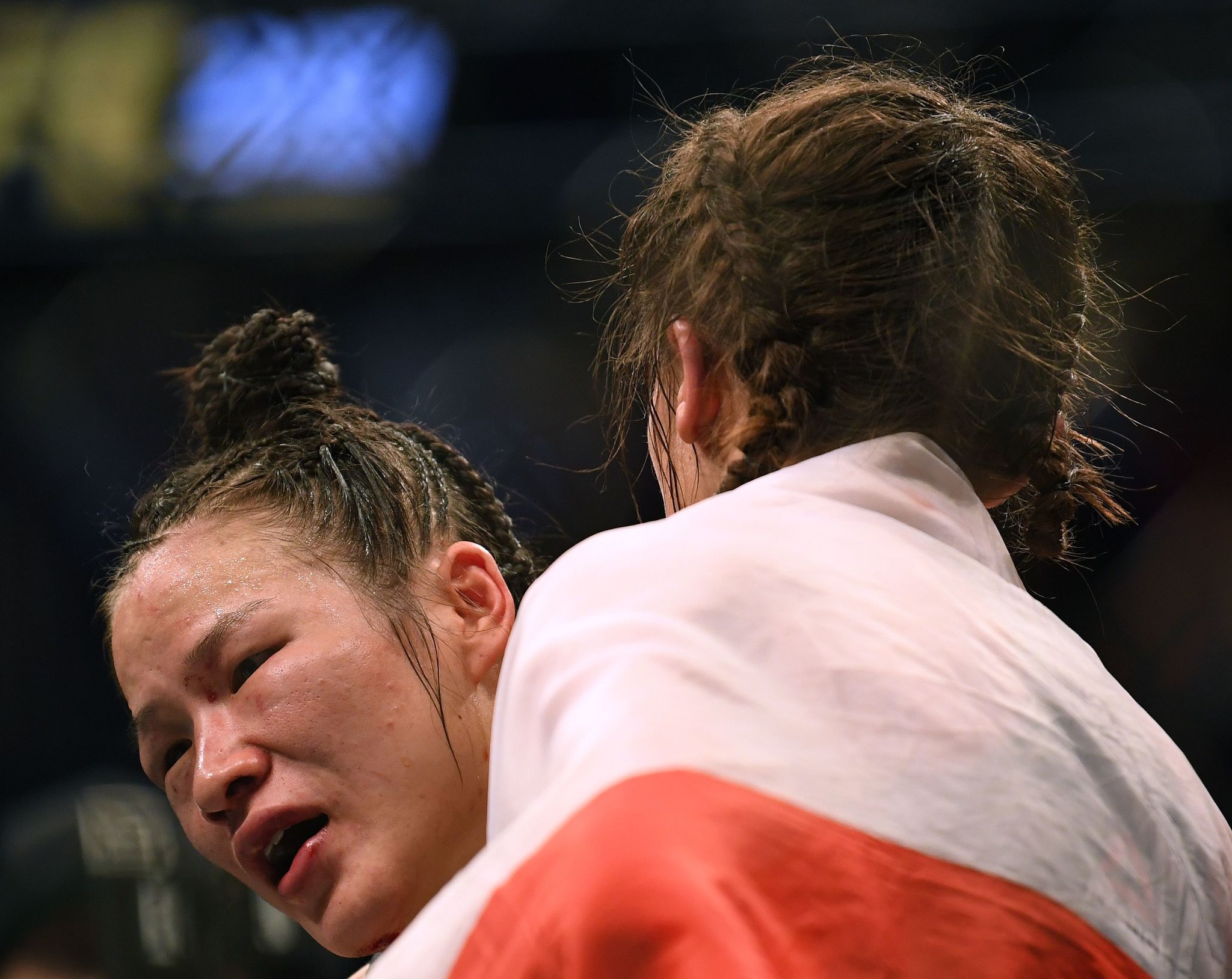 UFC 248: Jedrzejczy's face a week after it was pummelled - Foto 16 de ...