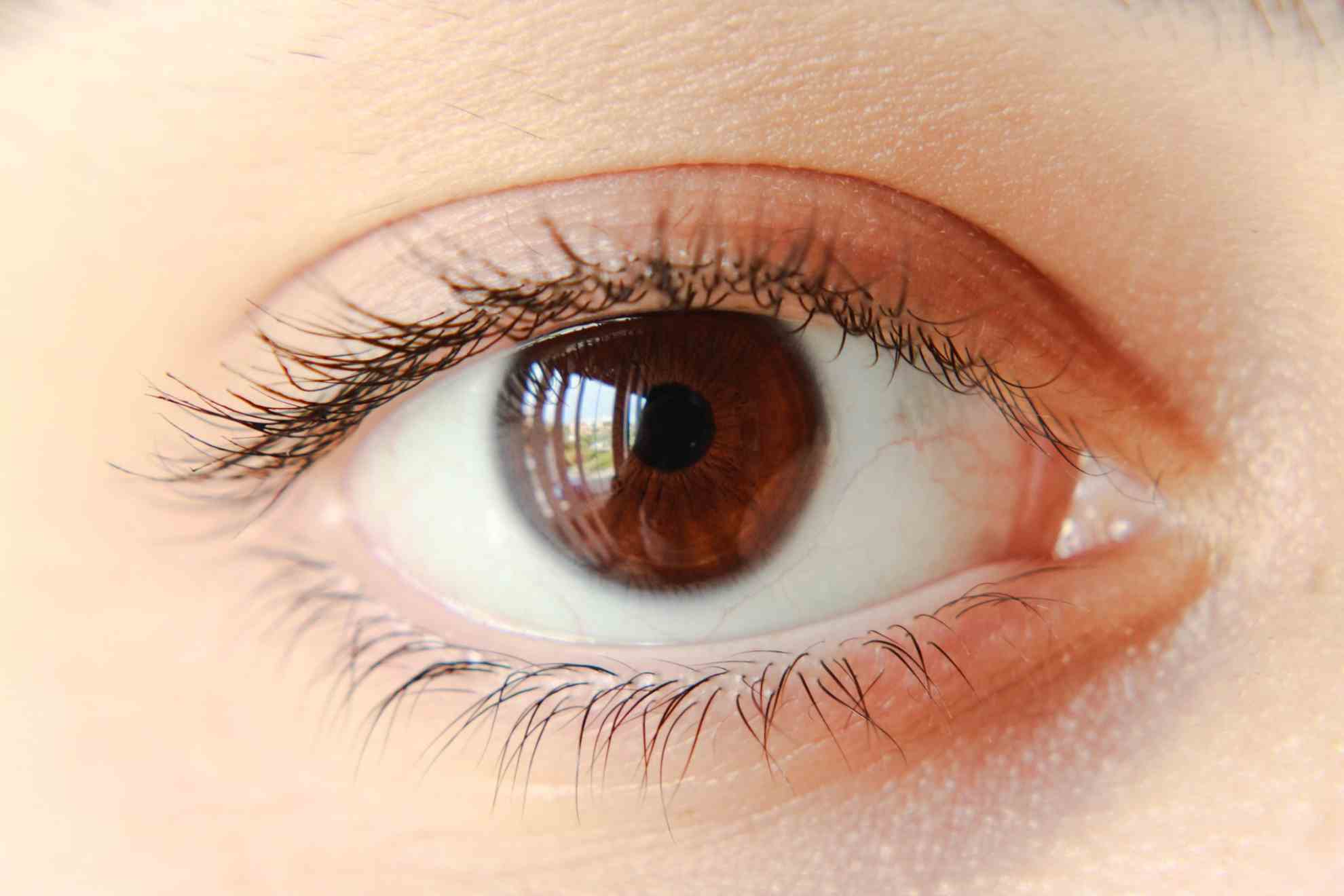 White Part Around Pupil