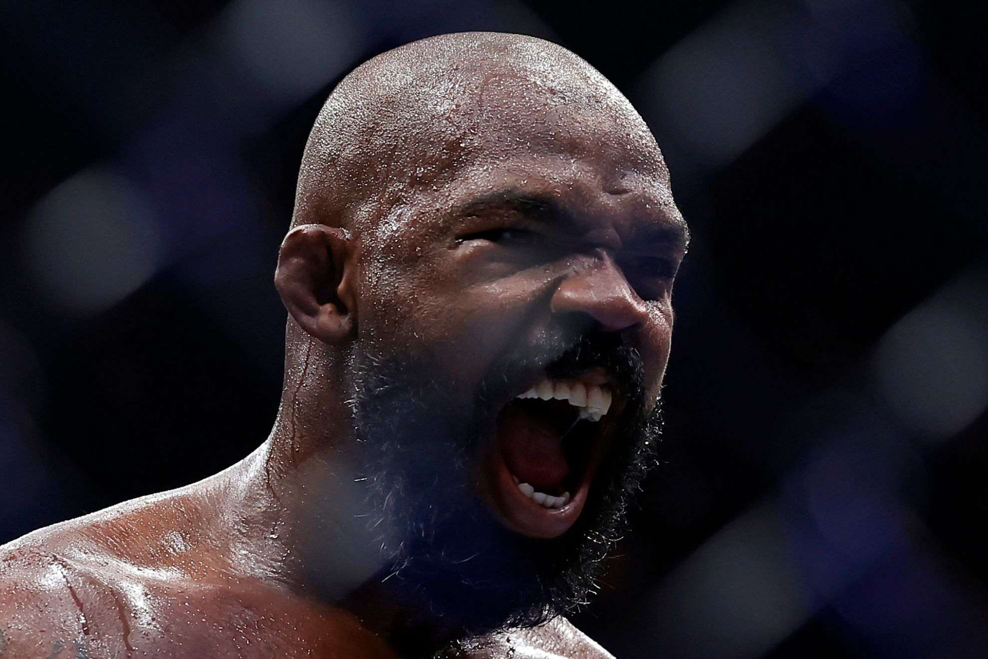 Jon Jones Hospital Fight